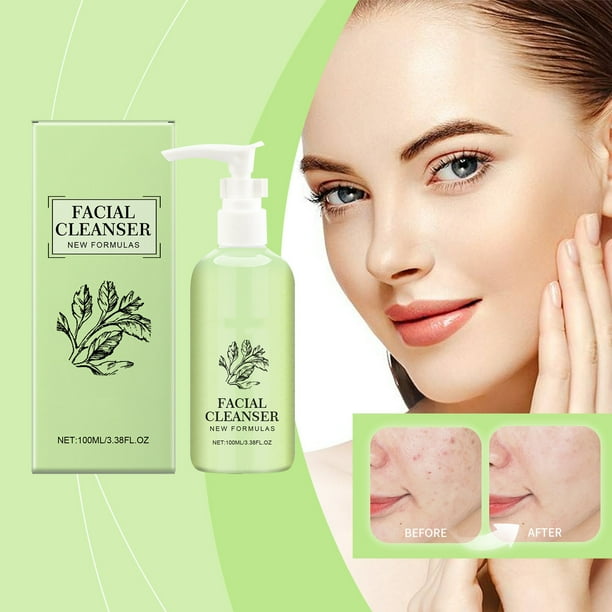 XWSHYW Limpiador Facial Limpiador Facial Limpiador Facial Hidratante Suave Limpiador Facial ...