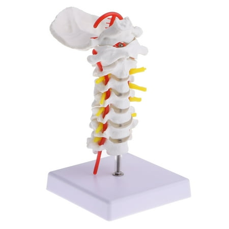 Lifesize Human Cervical Vertebra Spinal Nerves Model with Carotid ...