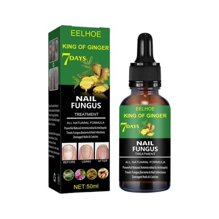 Anti-infective Liquid Hand and Foot Care Removal Repair Gel EELHOE ...