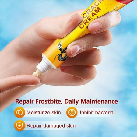 20g Anti-Crack Cream for Hand Anti-Crack Cream for and Foot ...