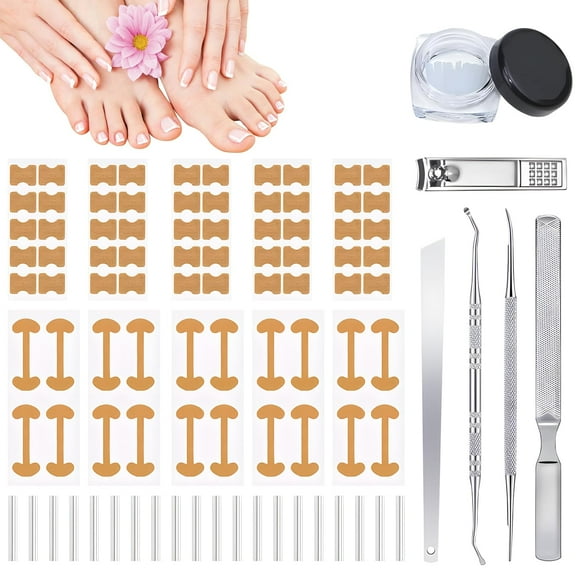 CurveCorrect Ingrown Toenail Corrector Kit, 10 Braces, Pain Relief ...