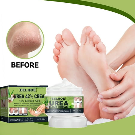 Archer 50g Foot Cream Non-irritating Safe Fast Absorption Moderate ...