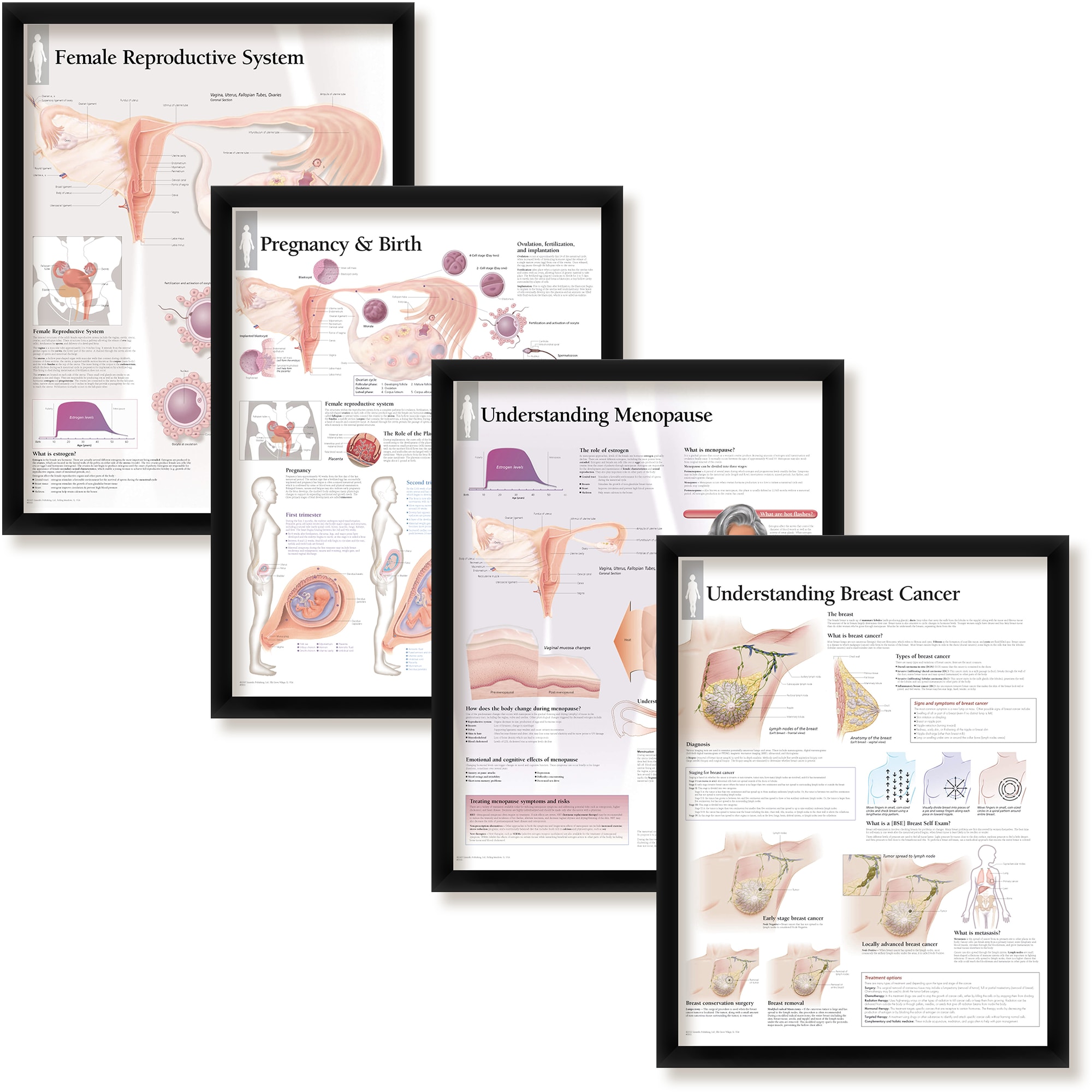 Set of 4 Framed Medical Posters Female Reproductive System Pregnancy ...