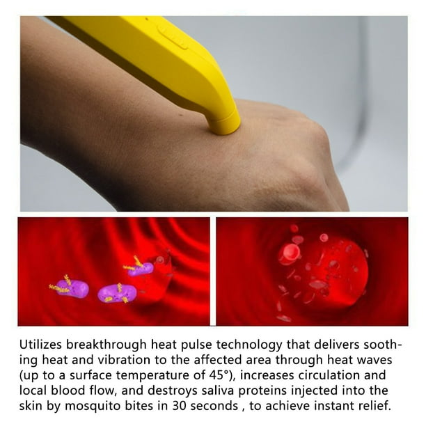 Electronic Anti Itch Pen,Electronic Anti Itch Pen Insect Bites Anti ...