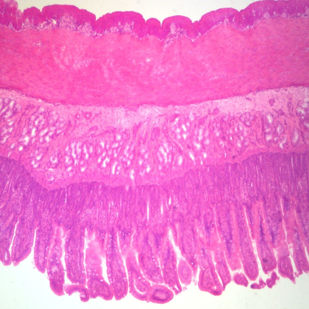 Small Intestine Slide