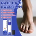 Nail Nutrient Solution, 10ml Treatment to Soothe Discomfort and Improve ...