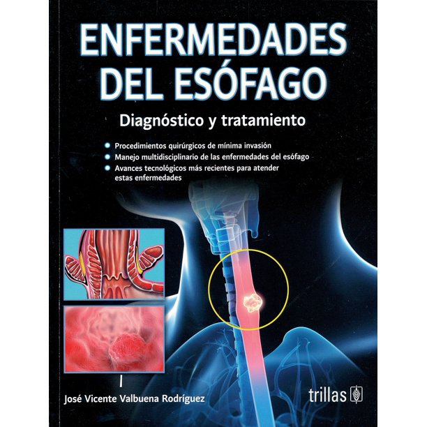 ENFERMEDADES DEL ESOFAGO: DIAGNOSTICO Y TRATAMIENTO EDITORIAL TRILLAS ...