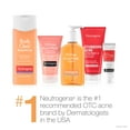 Neutrogena Body Clear Acne Body Scrub, 2% Salicylic Acid, 8.5 fl. oz ...