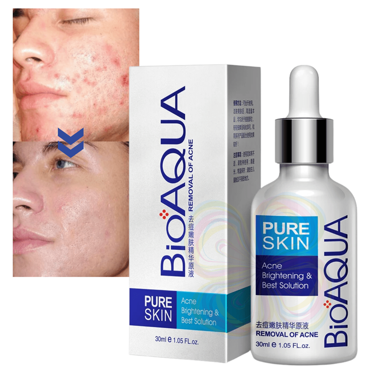 Serum Anti Acné Espinillas Granos Bioaqua Pure Skin Cuidado Facial 1 Pieza | Walmart en línea