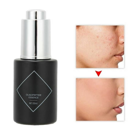 Oligopeptide Serum Moisturizing Serum Repair Serum Brightening Solution ...