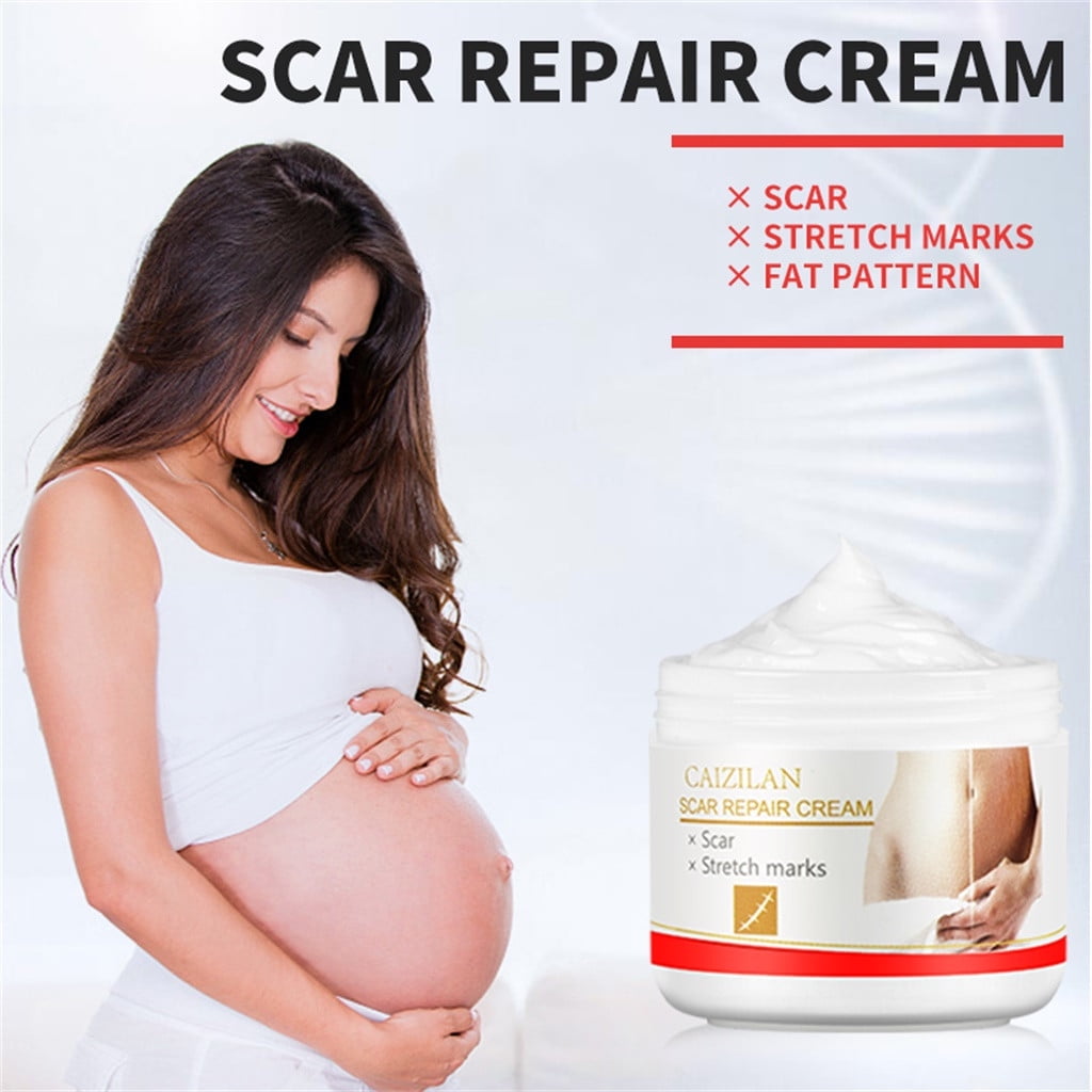 Removal Acne Scar Stretch Marks Scar Striae Gravidarum
