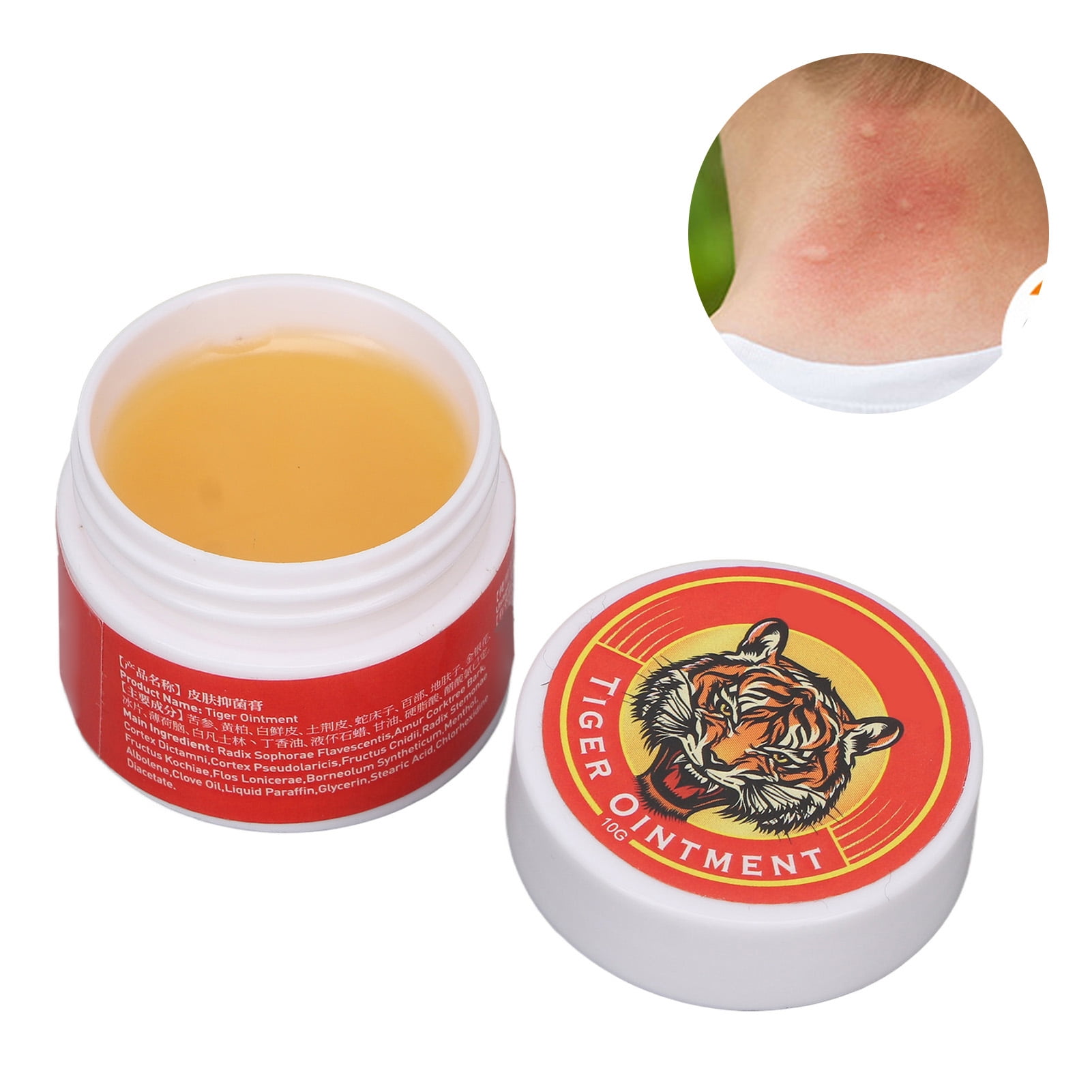 Ungüento Para La Picazón En La Piel, Crema Suave Para Aliviar La ...