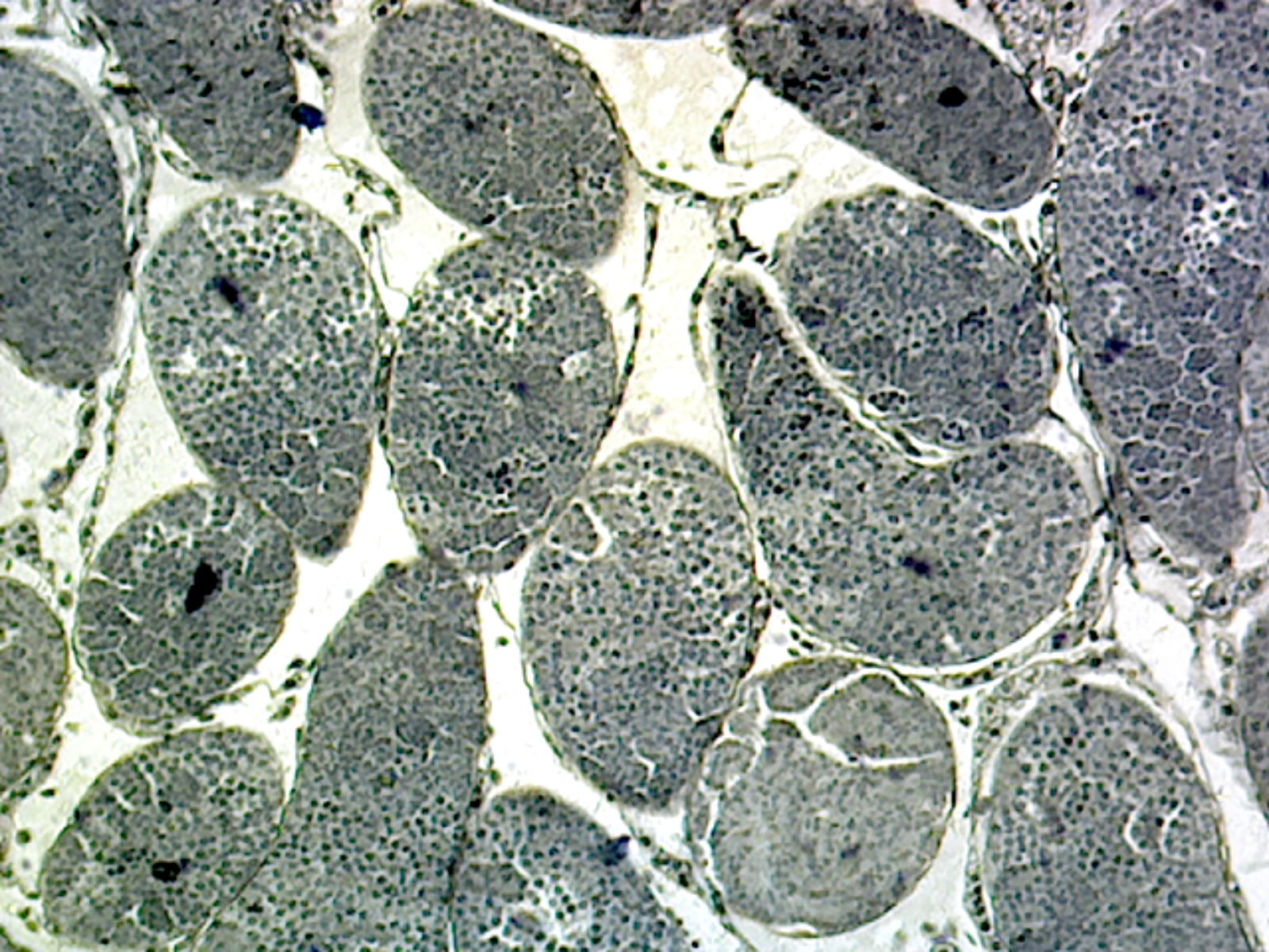 GSC International PS0209 Grasshopper Meiosis; Section - Walmart.com