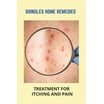 Shingles Home Remedies: Treatment For Itching And Pain: Shingles ...