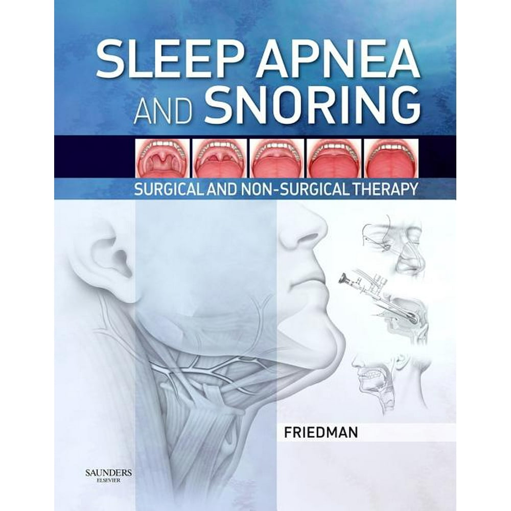Sleep Apnea And Snoring Surgical And Non Surgical Therapy