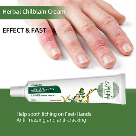 3 pieces Chilblain Cream 25g Anti-cracking Cream Herb Repair Foot/hand ...