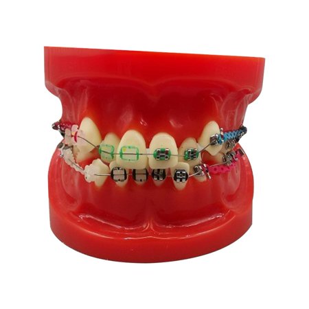 Dental Teeth Model For Teeth Correction Model Q5B4 - Walmart.ca