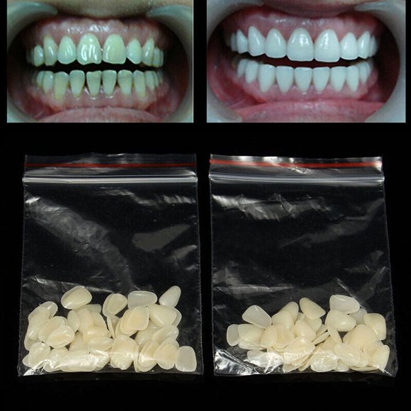 Temporary Dental Crown Kit