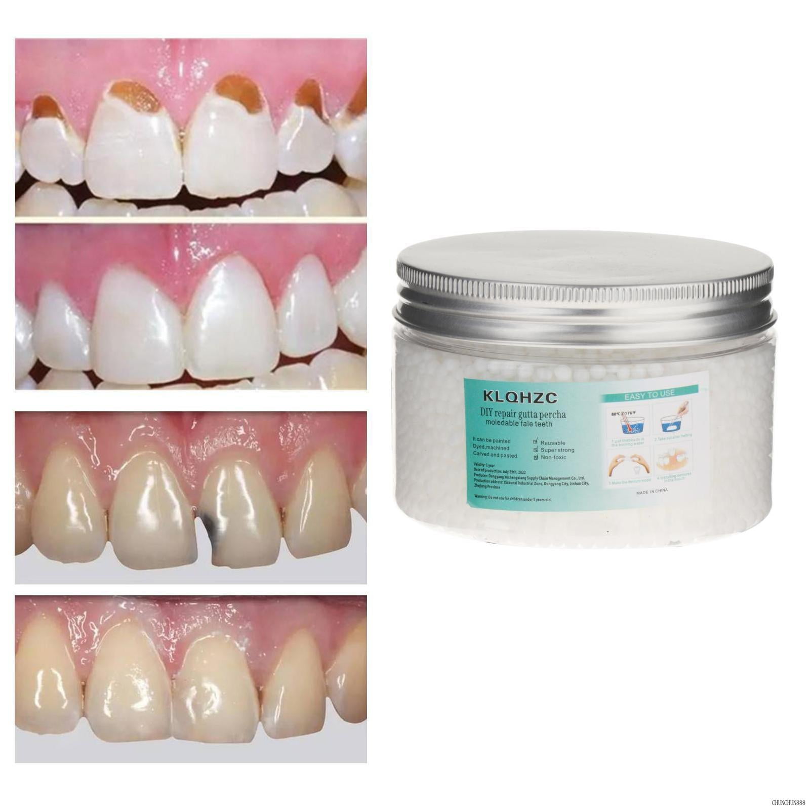 Temporary Tooth Filling Repair Kit Thermal Beads Solid Glue For Teeth Veneer