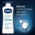 Vaseline Clinical Care Hand And Body Lotion Extremely Dry Skin Rescue