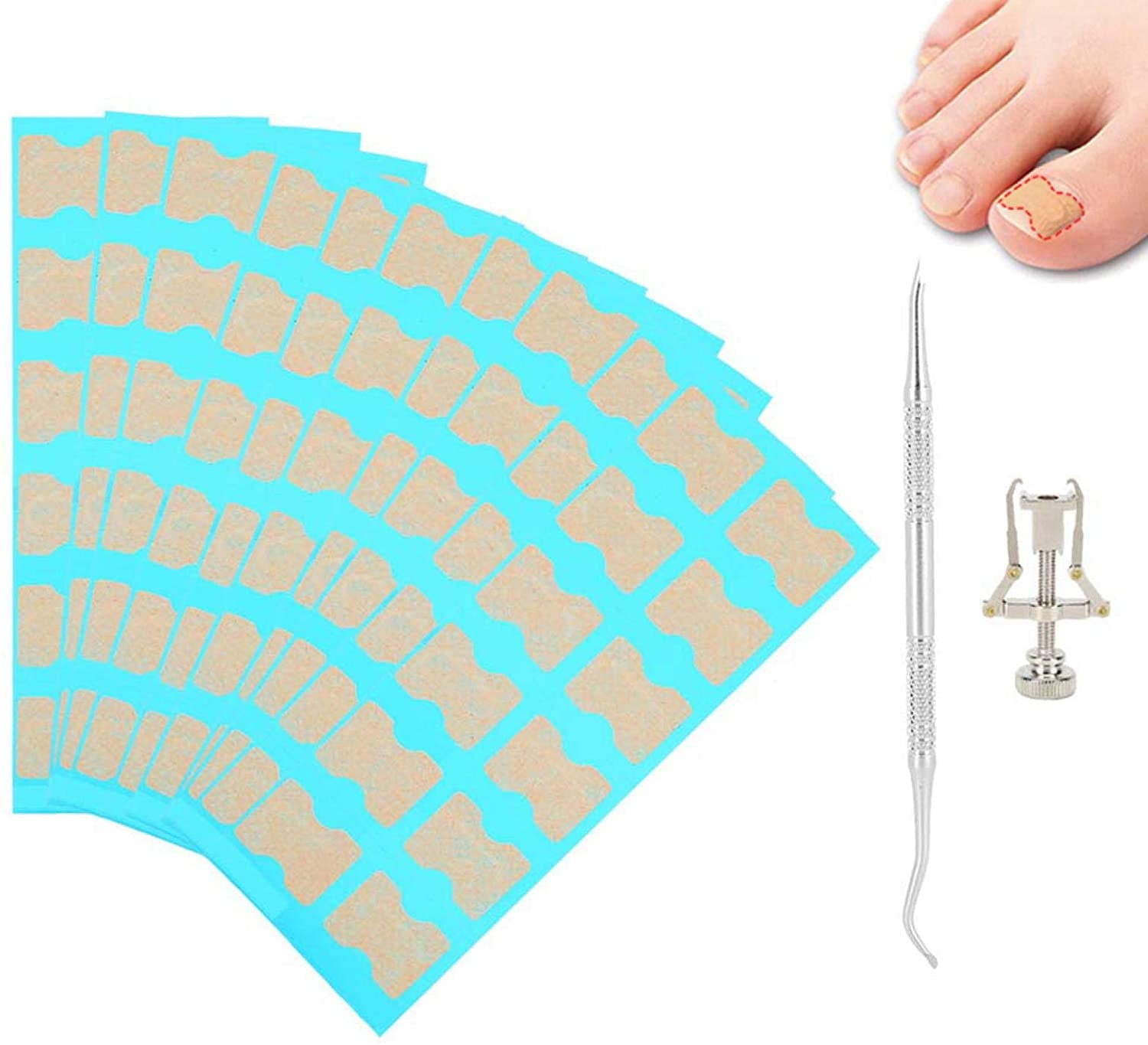 Ingrown Toenail Kit, Include Stainless Steel Corrector Toenail Stick ...