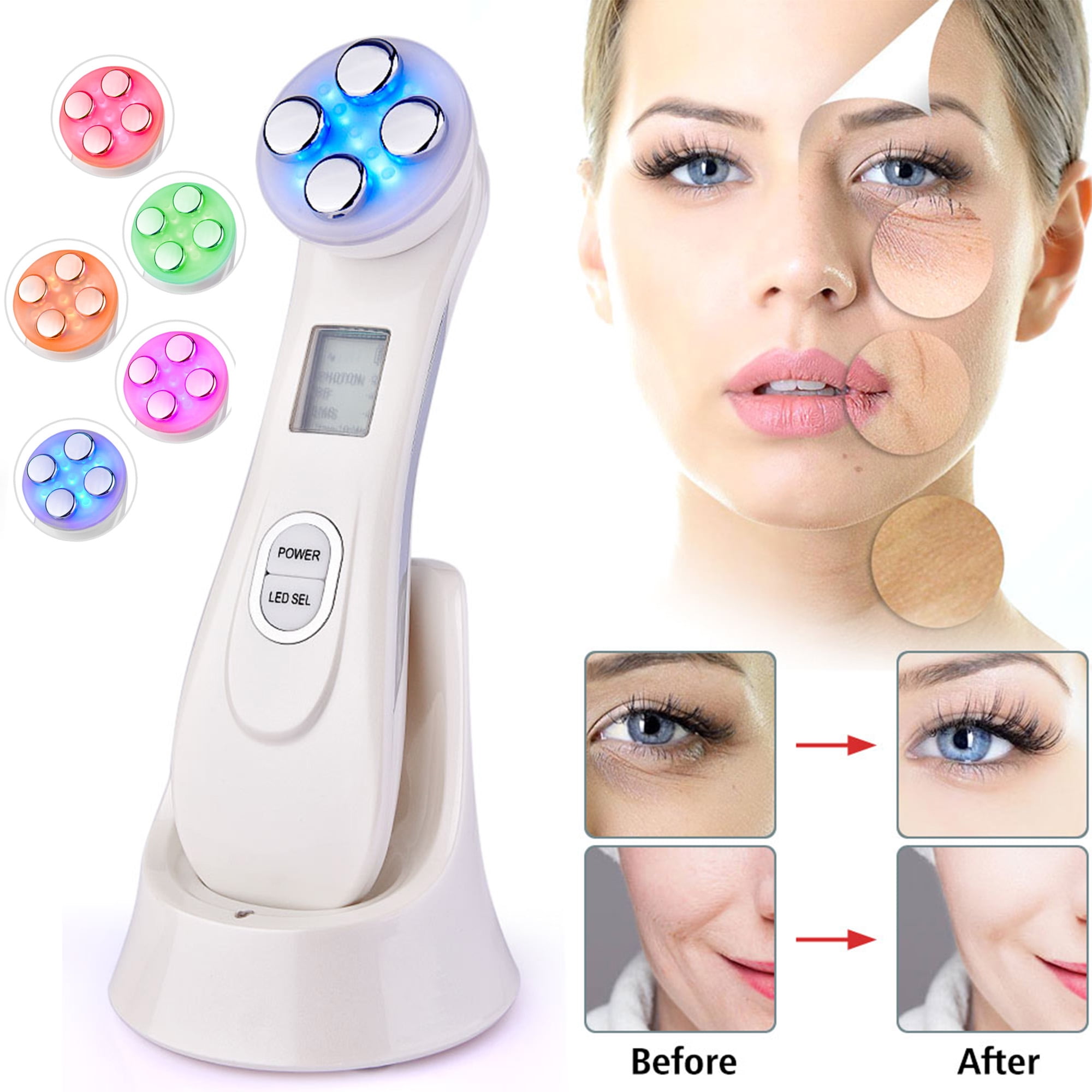 Click here for Afd Home Face Massage Device - 5 In 1 Rf Led Face... prices