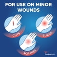 Telfa Adhesive Dressings “Ouchless”, 3” x 4” - Sterile, Non‑Adherent ...