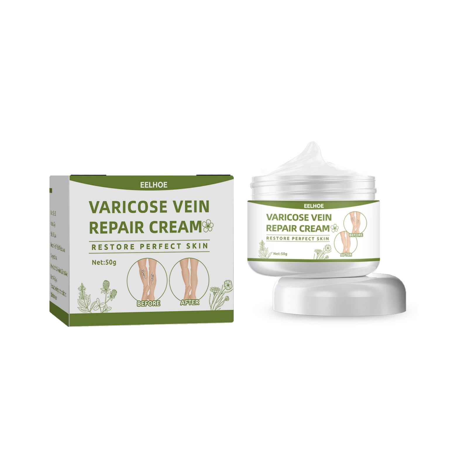 Buy Varicose Veins Cream, Spider Varicose Vein Treatment Cream For Legs ...