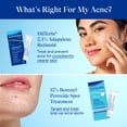 Differin Acne Spot Treatment with 10% Benzoyl Peroxide, Maximum ...
