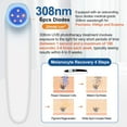 New 308nm Excimer Home Phototherapy Device for Skin Conditions UVB ...