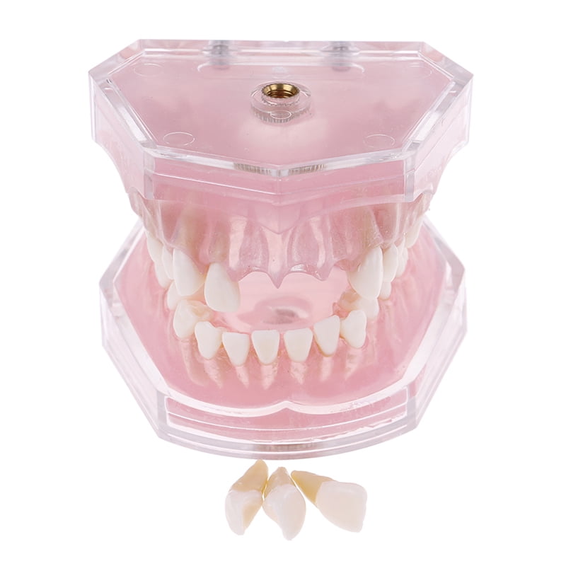 Standard Plastic Dental Model for Orthodontic Nepal | Ubuy