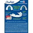 SleepRight ProRx Custom Dental Guard for Nighttime Teeth Grinding, 1 ...