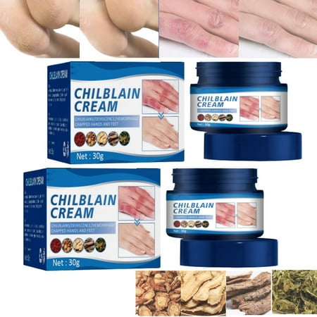 Chilblain Cream, Anti-cracking Frostbite Moisturiser Anti Crack Hand ...