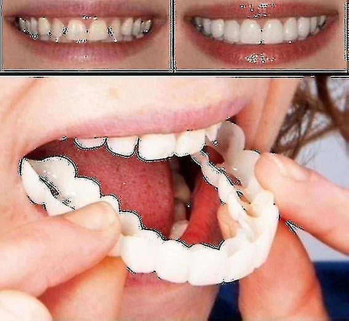 A Pair Upper Lower High Quality Denture Instant Smile Comfort Fit Flex ...
