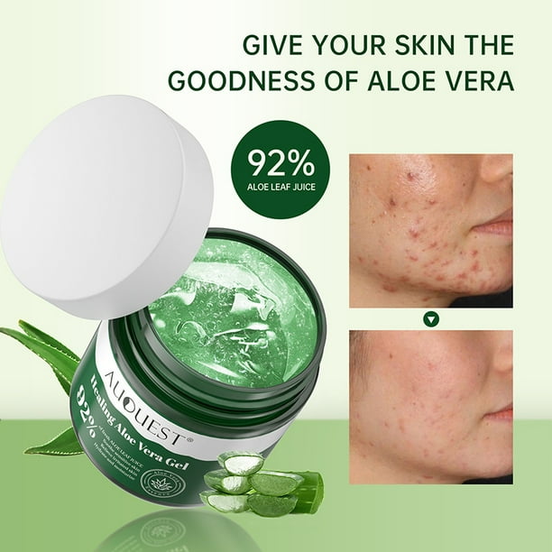 Aloe Vera Gel For Acne Scars Before And After
