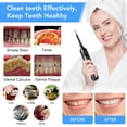 DearDental Ultrasonic Tooth Cleaner, Electric Plaque and Tartar Removal ...