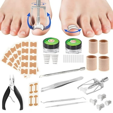 OTVIAP Ingrown Toenail Fixer Adjustable Toe Nail Paronychia Corrector ...