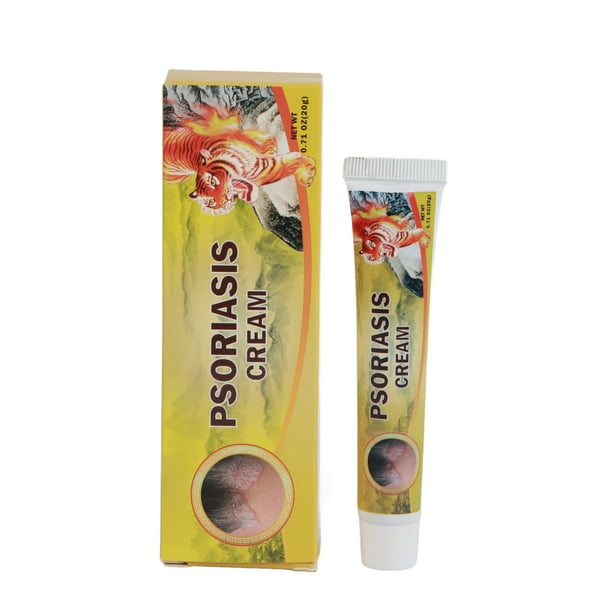 Crema calmante para psoriasis y dermatitis para una piel sana y alivio ...