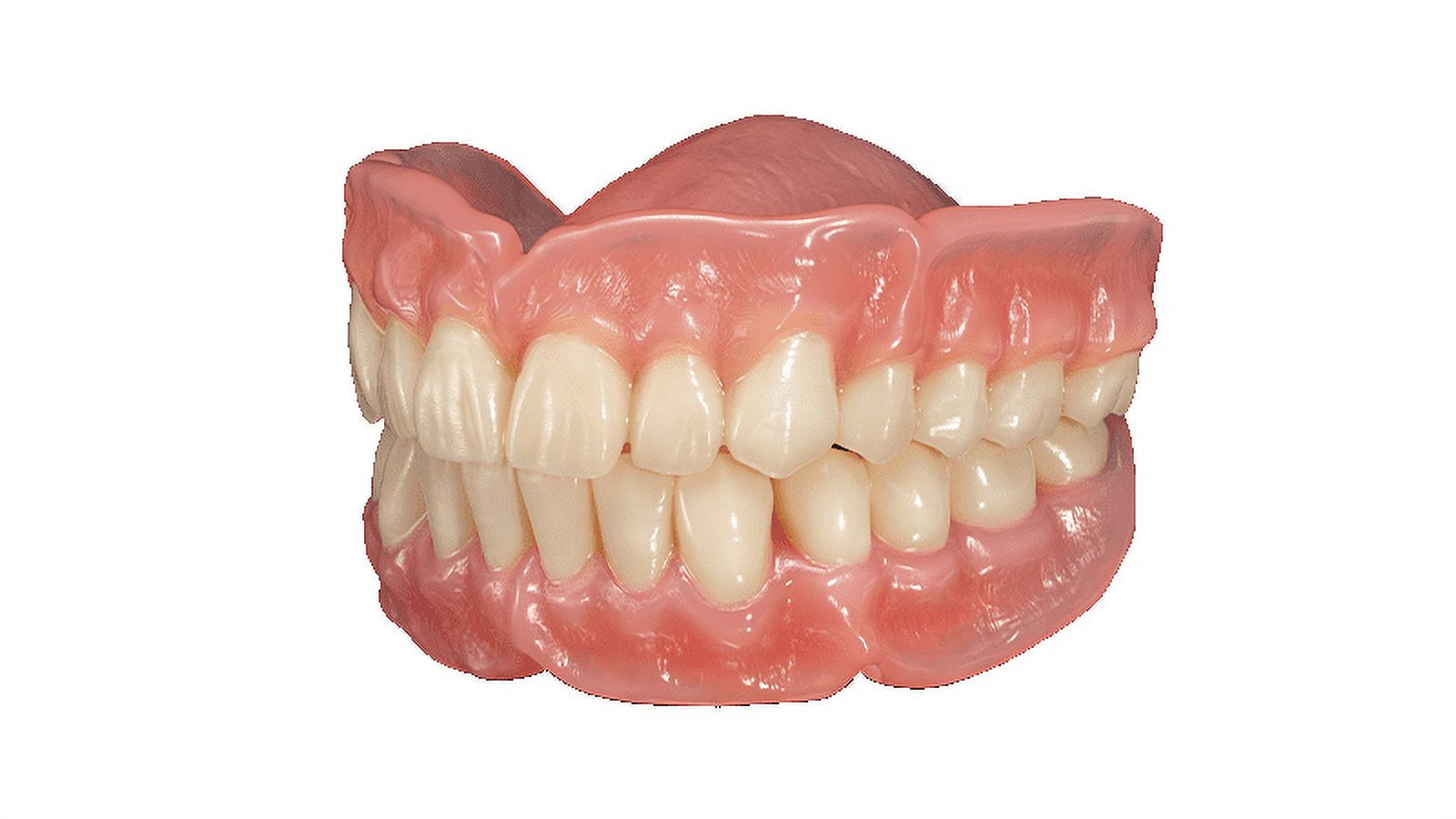 Diy Denture Kit PREMIUM With Impression Kit + Free Filling Kit - Full ...