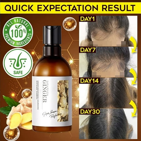 Hair Volumizing Ginger Shampoo Hair-active Root-boost Ginger Spray Regrowth Nourishing Ginger ...