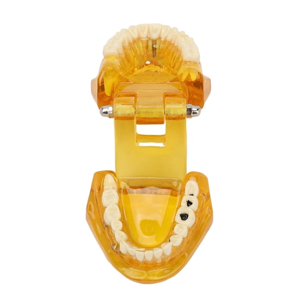 Transparent Model, Clear Structure Study Transparent Model Better ...