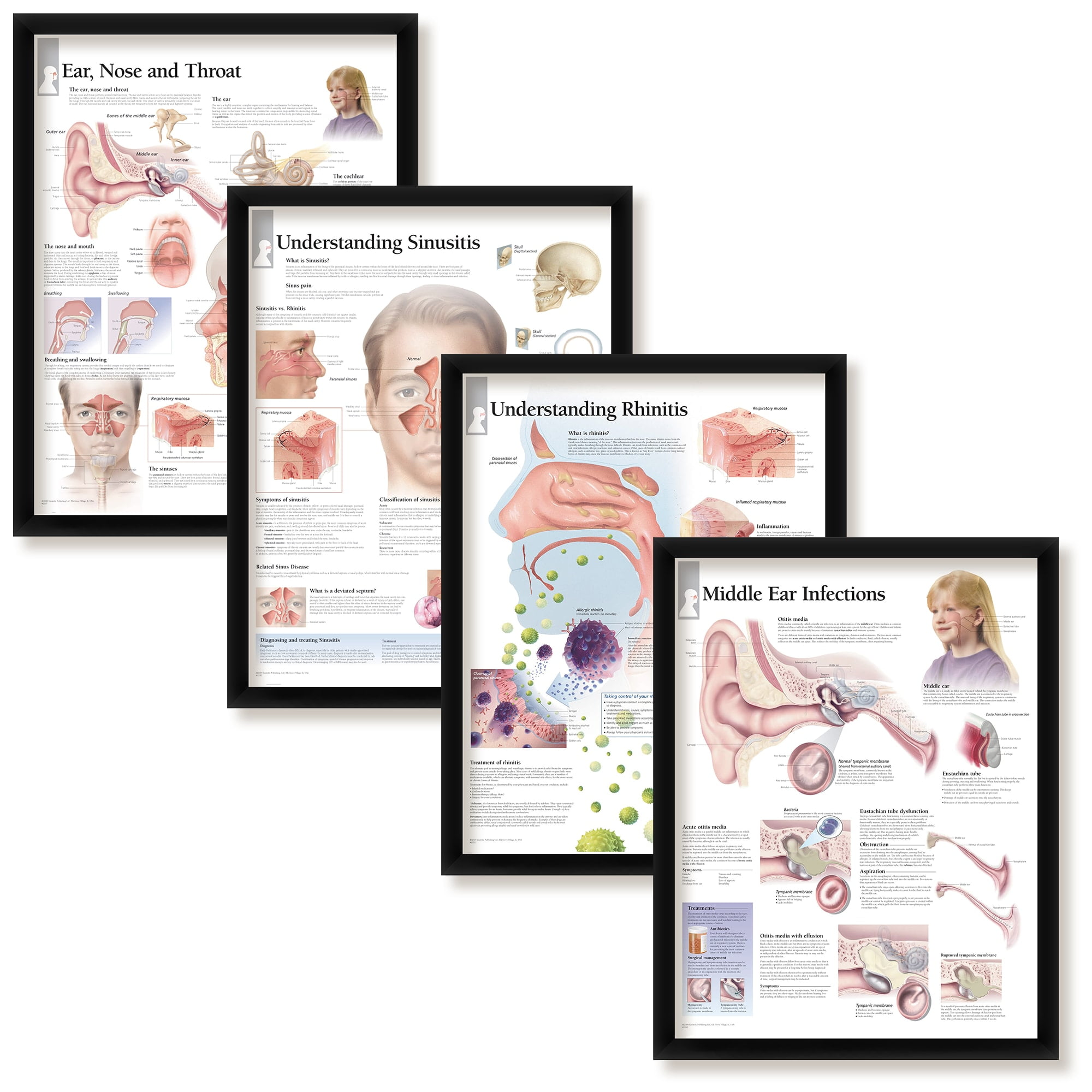Set of 4 Framed Medical Posters Ear, Nose and Throat, Understanding ...