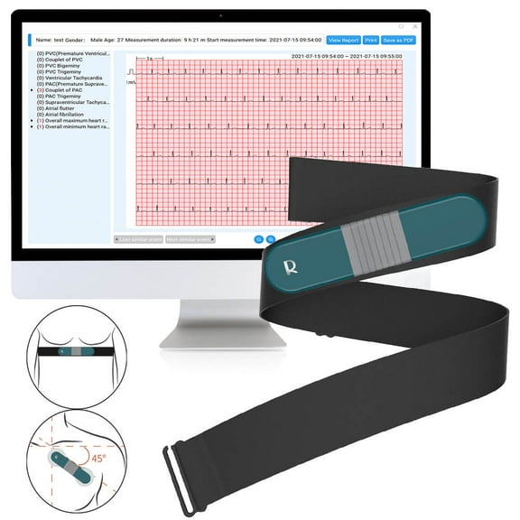 EMAY Bluetooth EKG Machine | Portable ECG Monitor for iPhone, Android ...