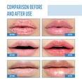 Natural Collagen Lip Improvement Lip Patch Overnight Lip Sleeping Sheet ...
