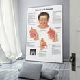 Anatomical Poster Rhinitis And Sinusitis Posters Wall Art Picture ...