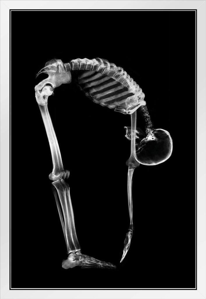 Skeleton Bending Touching Toes Anatomy X Ray Photo Poster Human Body ...