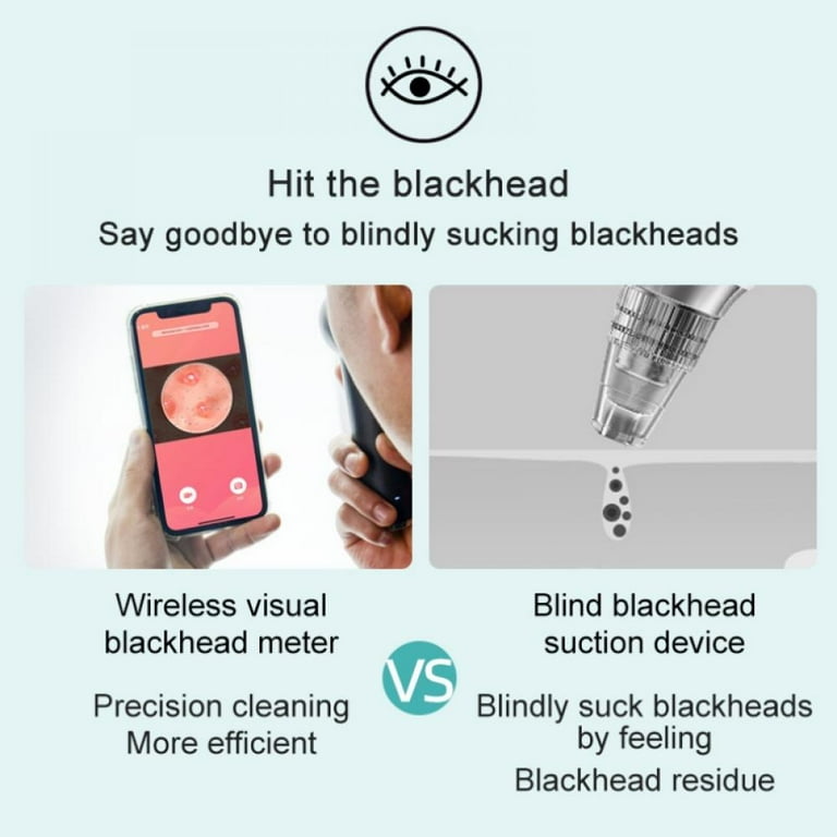 Blackheads Microscope