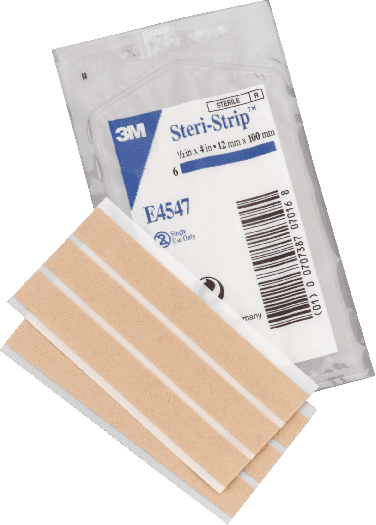 Sunk Into Steri Strips
