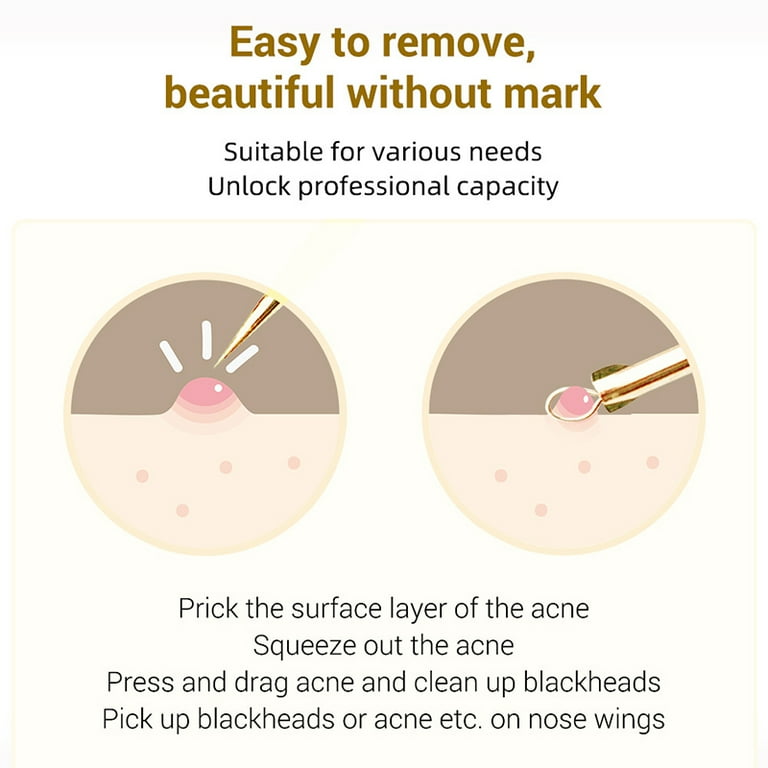 Blackhead Removal Diagram