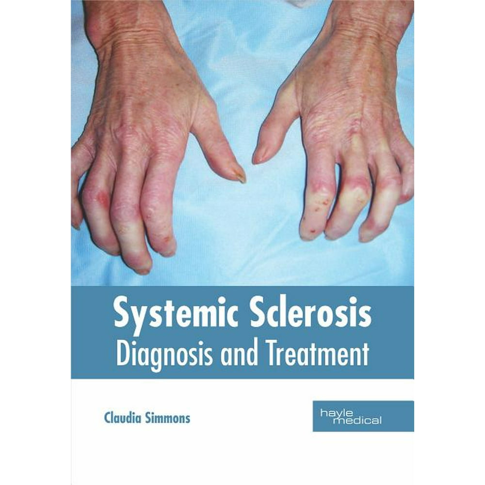 Systemic Sclerosis: Diagnosis and Treatment (Hardcover) - Walmart.com ...